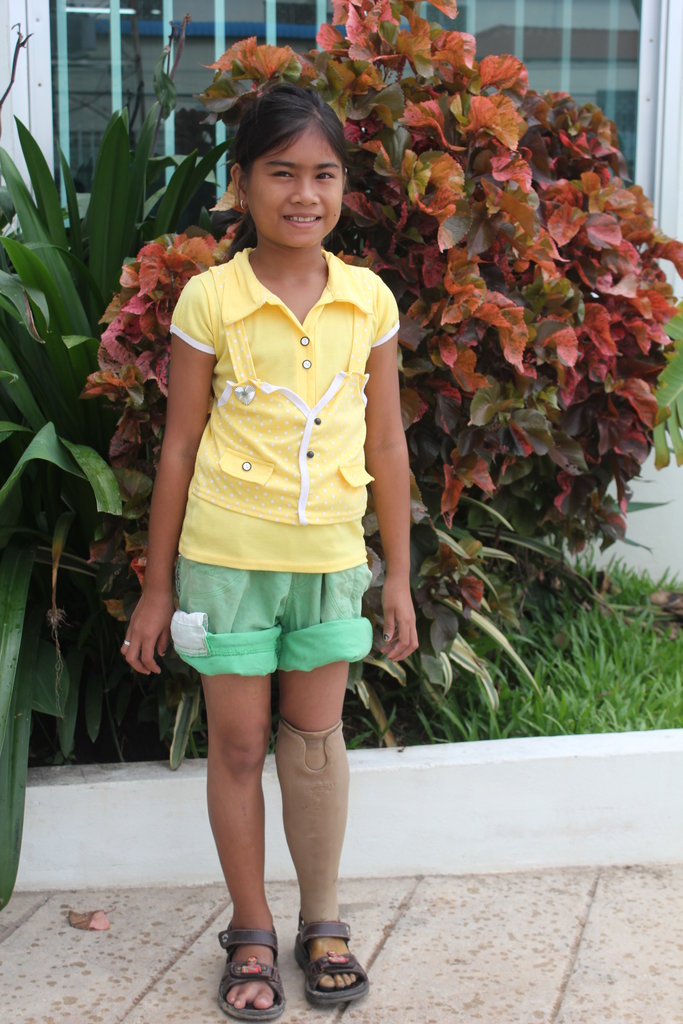Give 40 Children in Asia the Ability to Walk! - GlobalGiving
