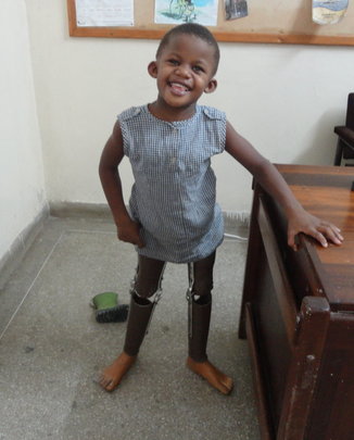 Give 40 Children in Asia the Ability to Walk! - GlobalGiving