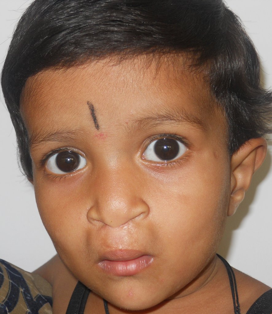 Smiling Faces - free reconstructive facial surgery - GlobalGiving