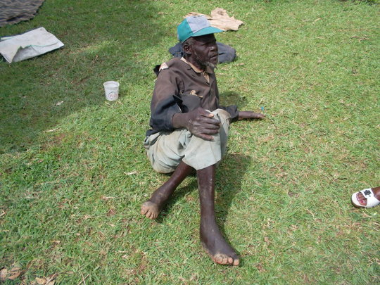 Eradicate jiggers in 3 districts in Kenya - GlobalGiving
