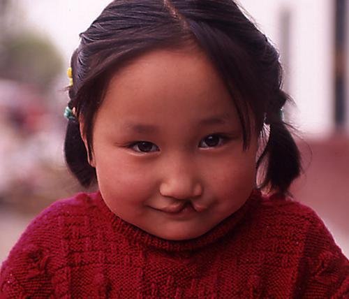 Free Cleft Surgery for 600 Poor Chinese Children - GlobalGiving