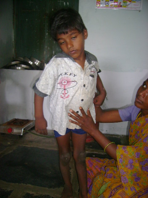 Help for handicapped and poor children in India - GlobalGiving