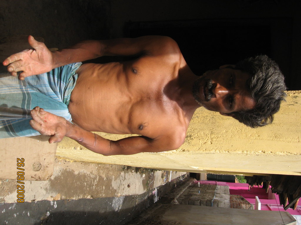 Free Medical Care for Poor Lepers - GlobalGiving