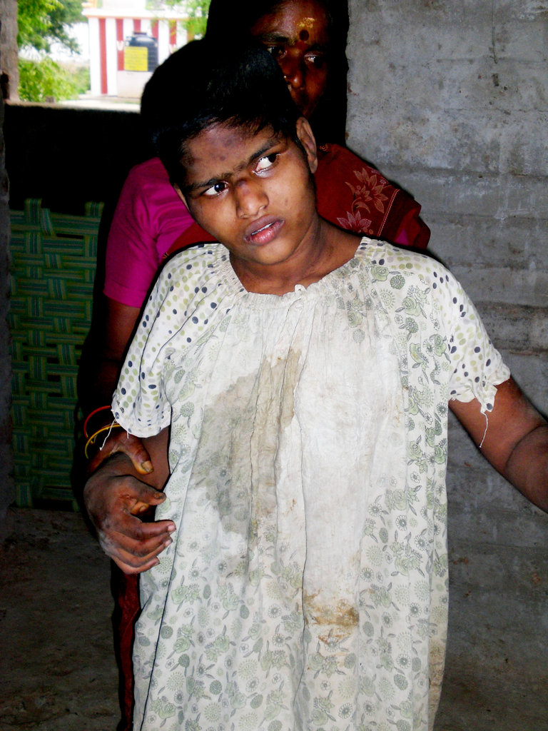 Deformed Leper & poor disable youth therapy Centre - GlobalGiving
