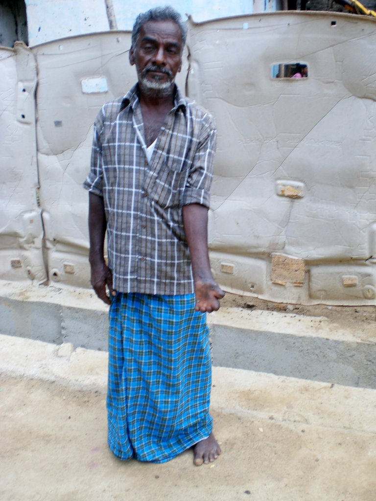 Deformed Leper & poor disable youth therapy Centre - GlobalGiving