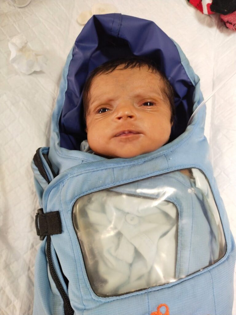 Reports On Eye Screening For Premature Babies GlobalGiving Reports On Eye Screening For Premature Babies GlobalGiving
