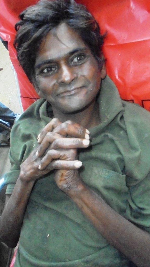 Support a patient Save a Life ! - GlobalGiving