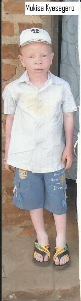 Build a School for 200 Children with Albinism - GlobalGiving