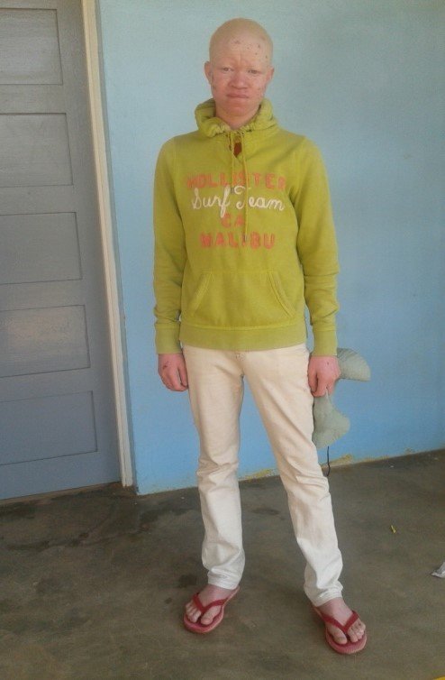 Build a School for 200 Children with Albinism - GlobalGiving