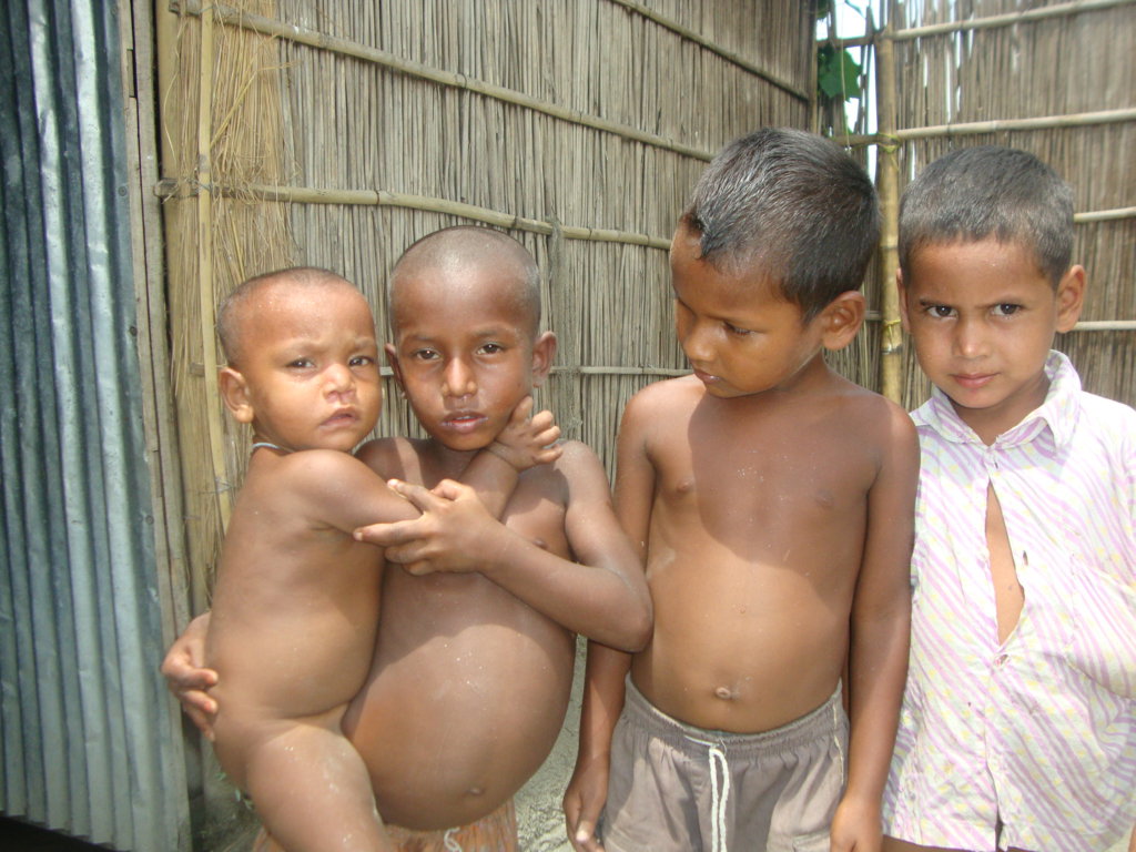 Restoring visions of 500 poor blinds in Bangladesh - GlobalGiving