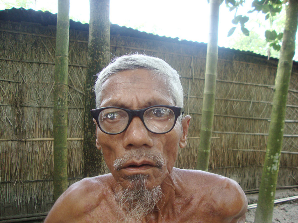 Restoring visions of 500 poor blinds in Bangladesh - GlobalGiving