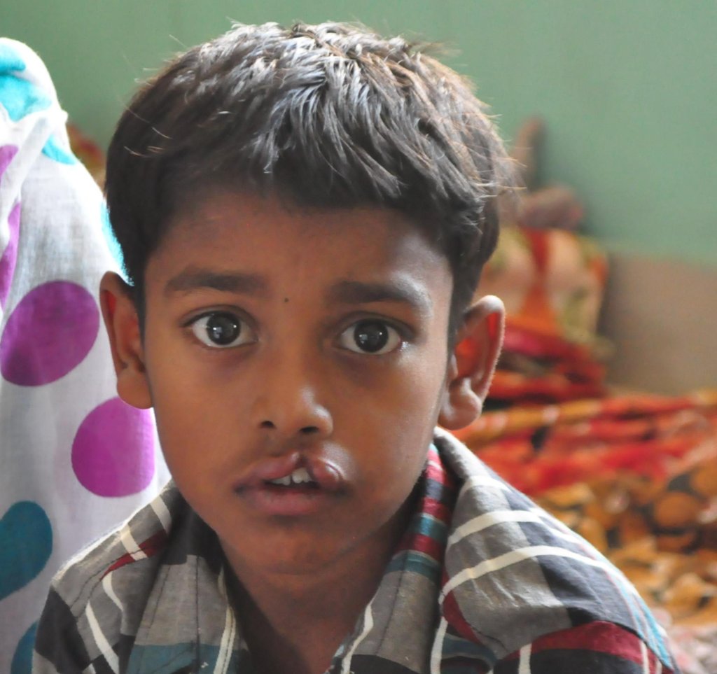 100 Smiles in 100 Days - GlobalGiving