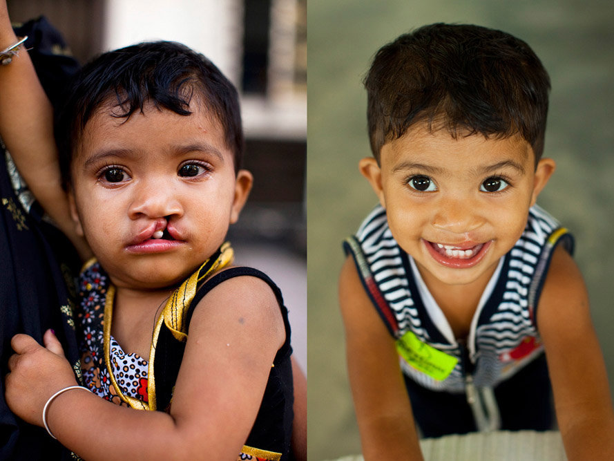 100 Smiles in 100 Days - GlobalGiving