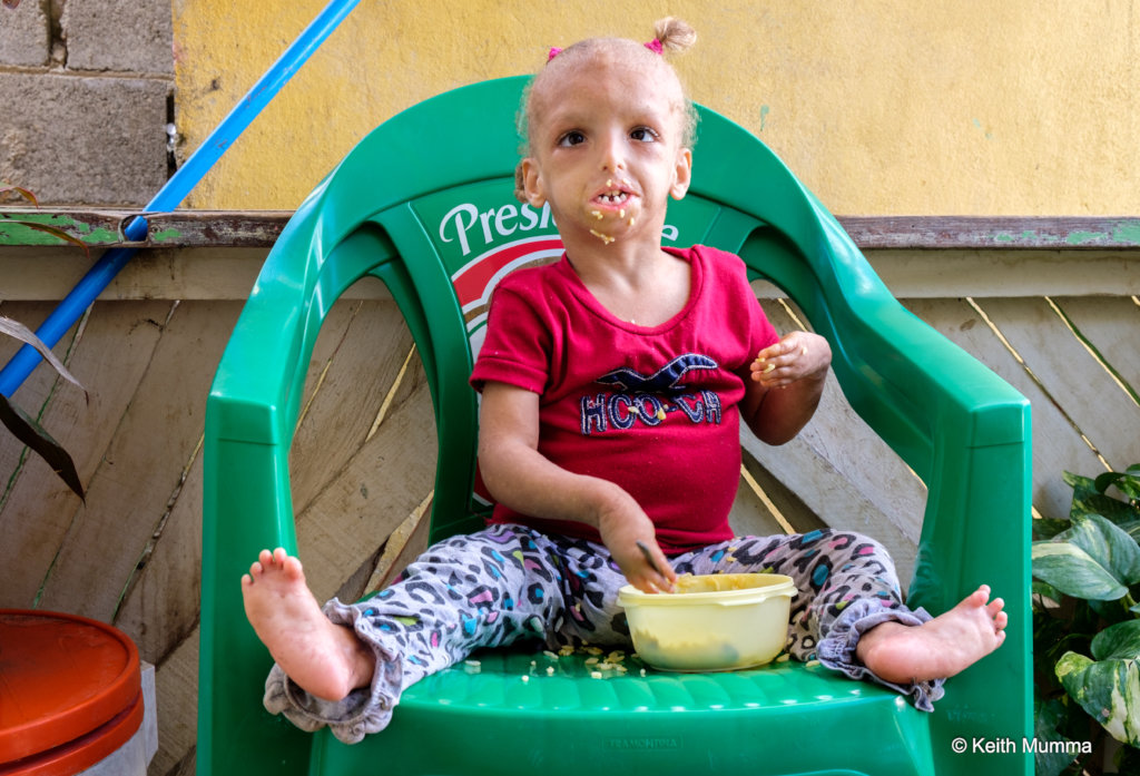 100 Dominican disabled children more independent - GlobalGiving