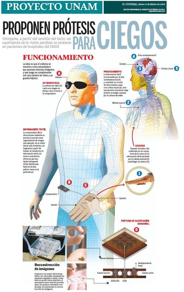 Human Artificial Vision. Prosthesis for the blind. - GlobalGiving