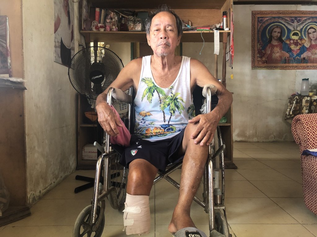 Artificial leg for David - GlobalGiving