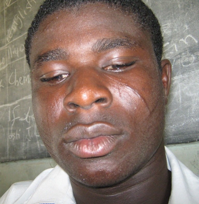 Eradication Of Facial Mutilation In Moro LGA,Kwara - GlobalGiving