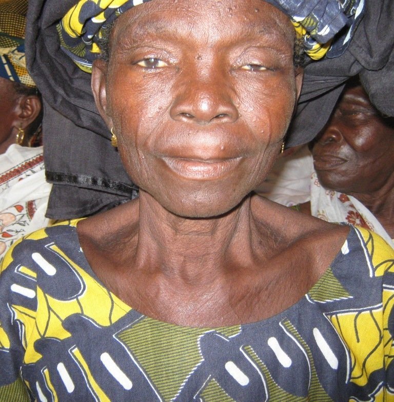 Eradication Of Facial Mutilation In Moro LGA,Kwara - GlobalGiving