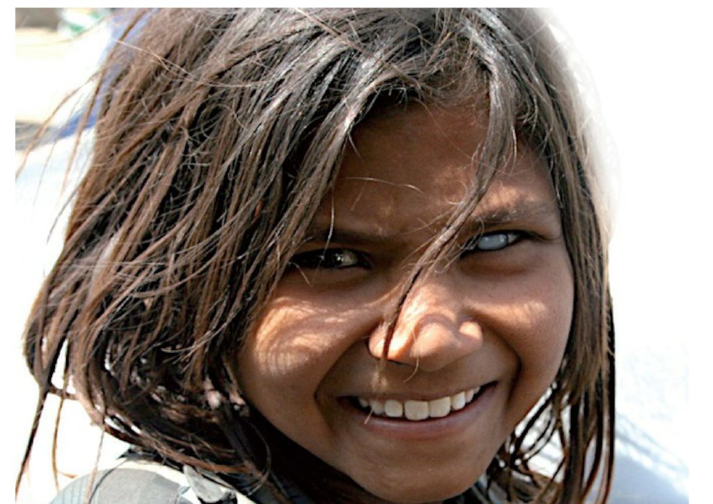 RANCHI EYE CARE CENTRE - GlobalGiving