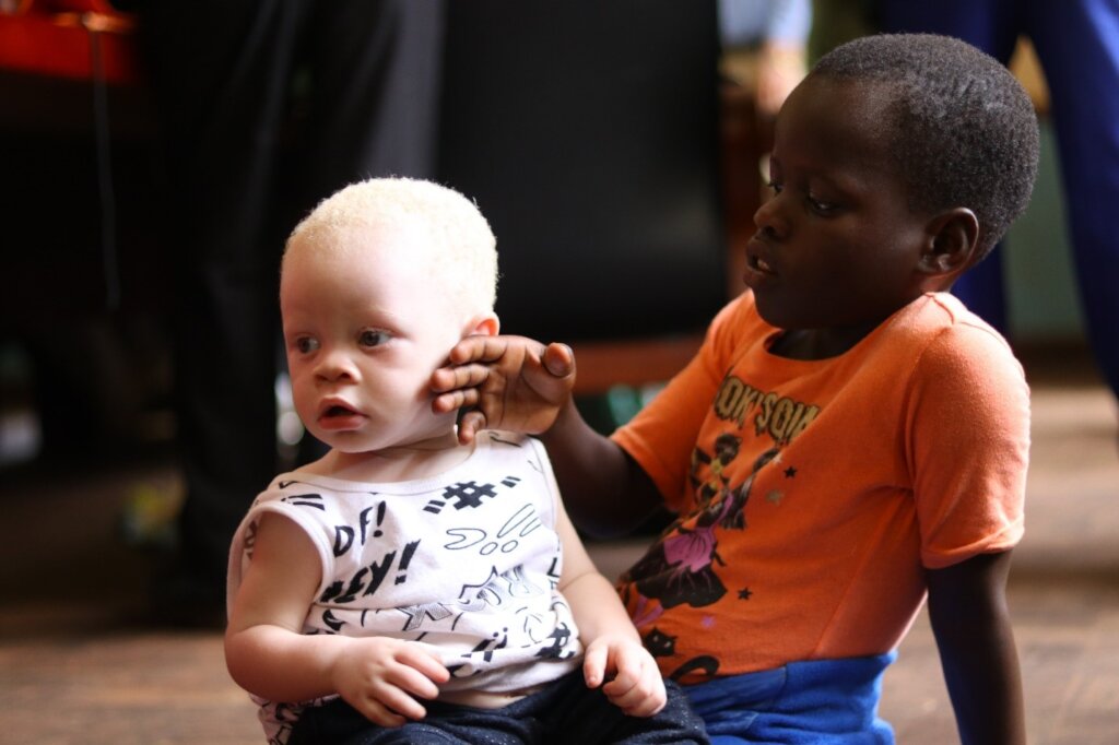 Reports on End skin cancer for people with albinism in Uganda ...