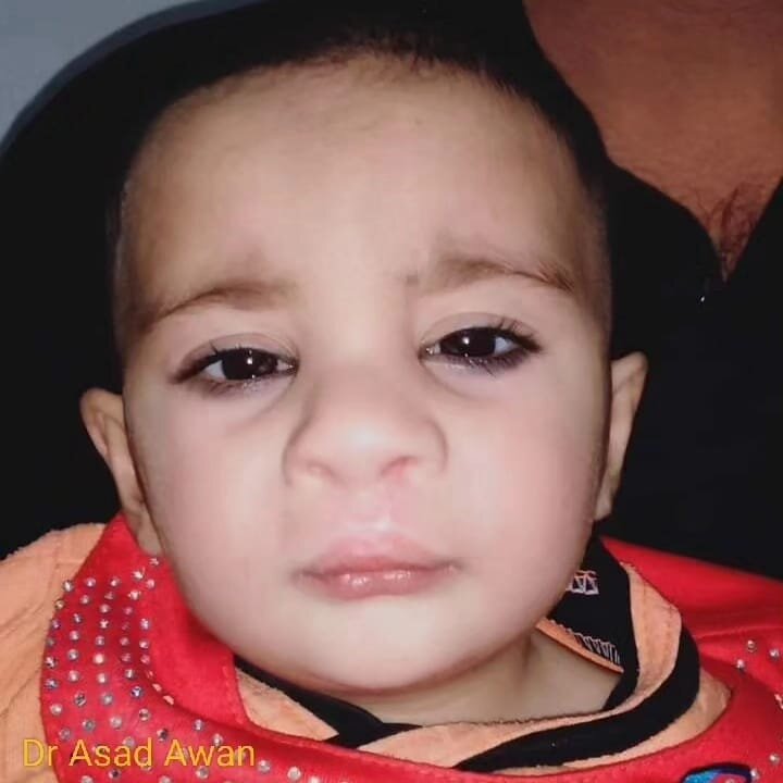 Restore Smiles of Cleft Patients - GlobalGiving