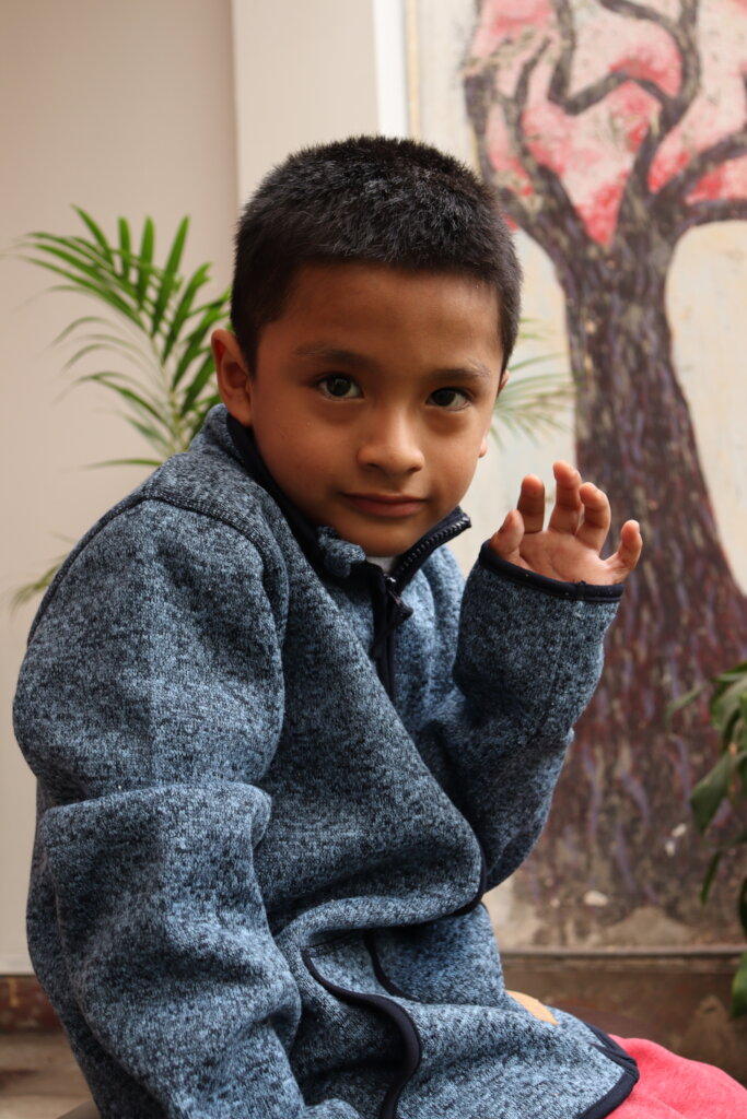 Burn children need your help! - GlobalGiving