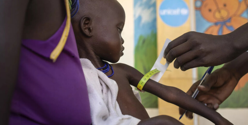 Donate to SUPPORT MALNOURISHED CHILDREN TO REDUCE MORTALITY - GlobalGiving