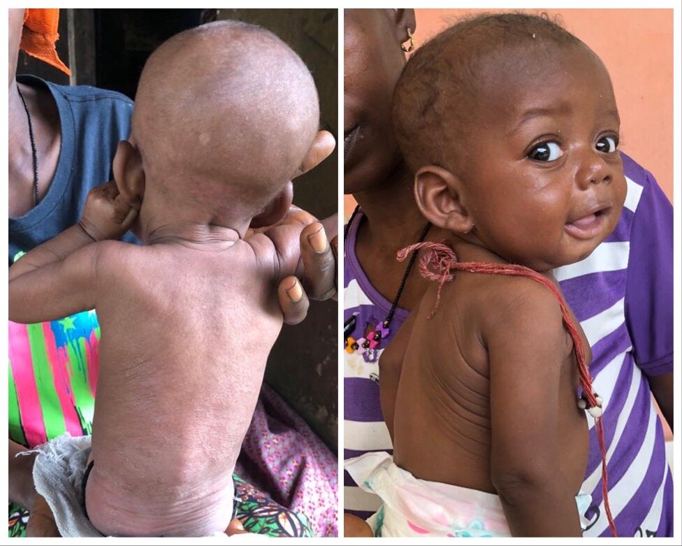 Donate to Support orphans and malnourished infants. - GlobalGiving