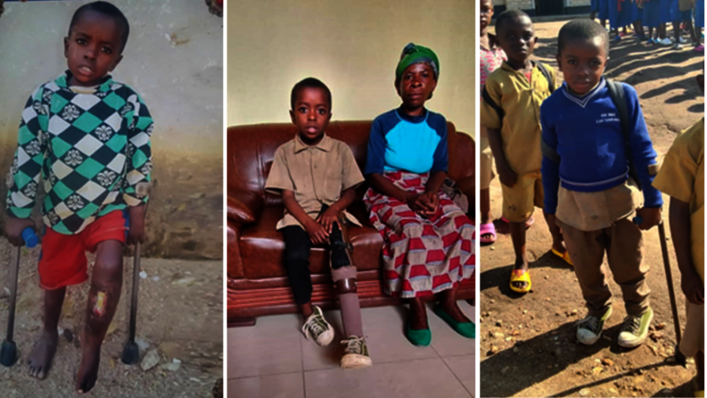 Donate to Rwanda: Literacy for children with disabilities - GlobalGiving