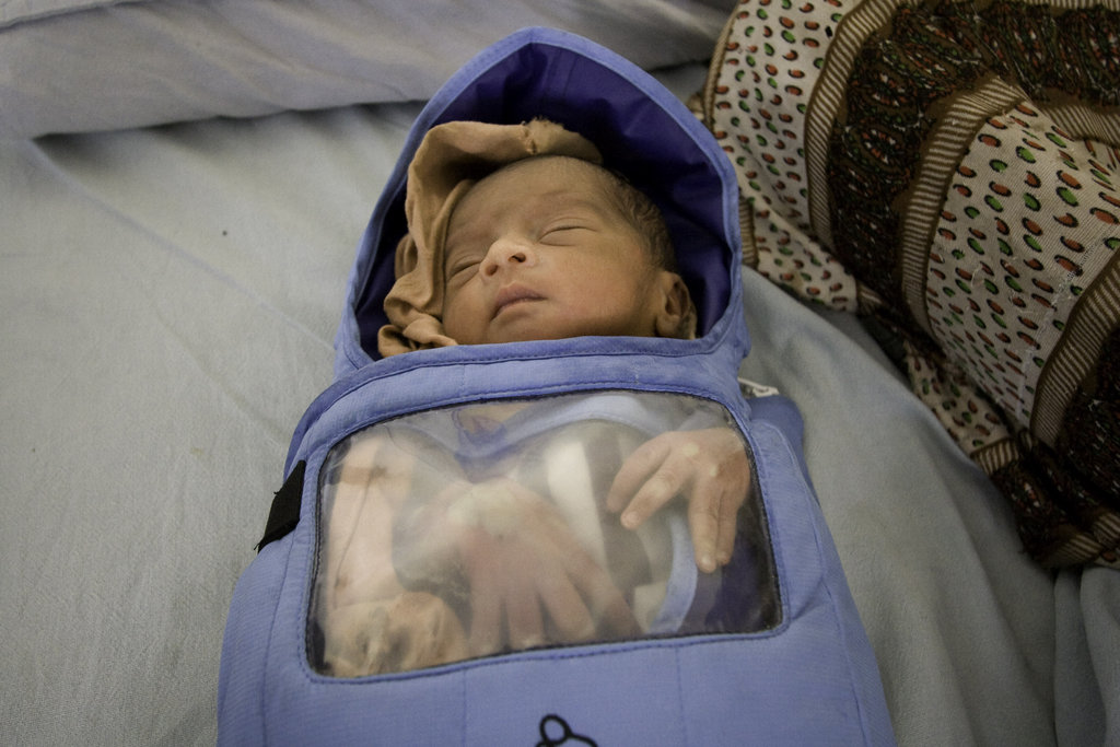 Embrace Infant Warmers Impact Babies Lives India - GlobalGiving