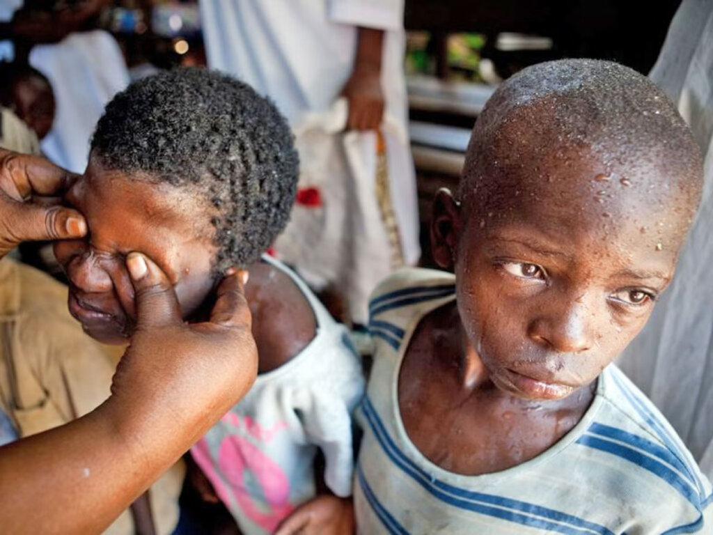 Save Children Accused of Witchcraft in Africa - GlobalGiving