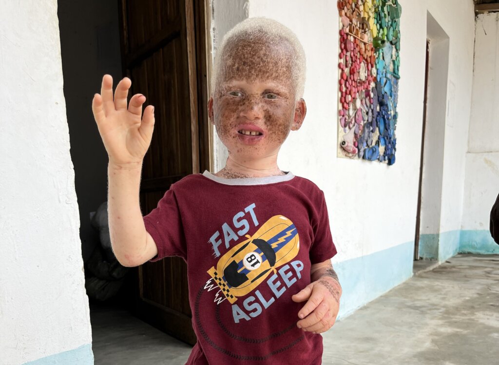 Luz - Sunscreen for Children with Albinism - GlobalGiving