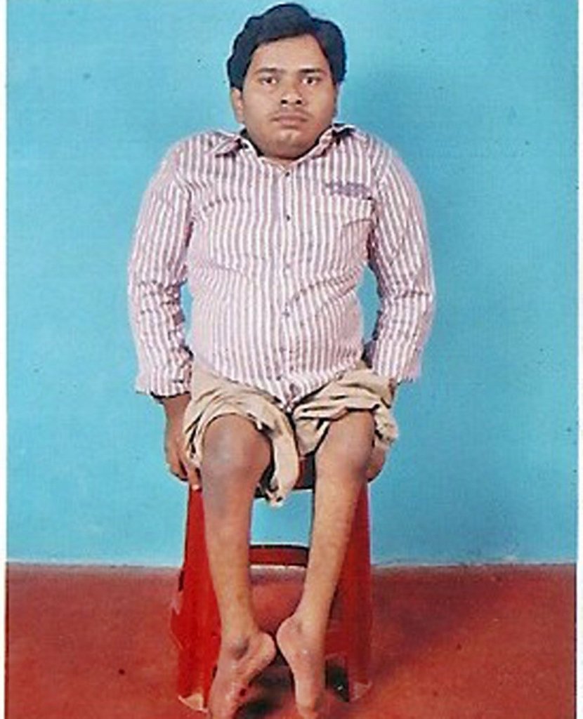 Skill Development for Disabled Youth in India - GlobalGiving