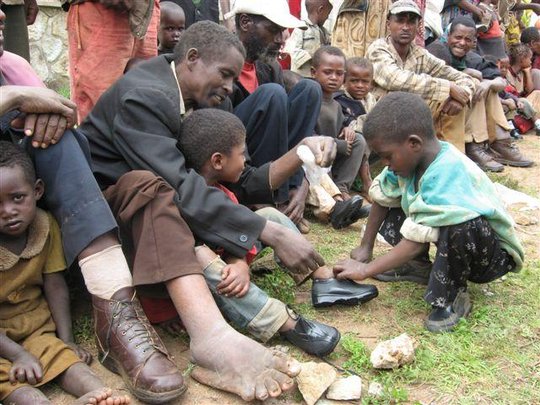 Mossy Foot Project - Village Clinics - GlobalGiving